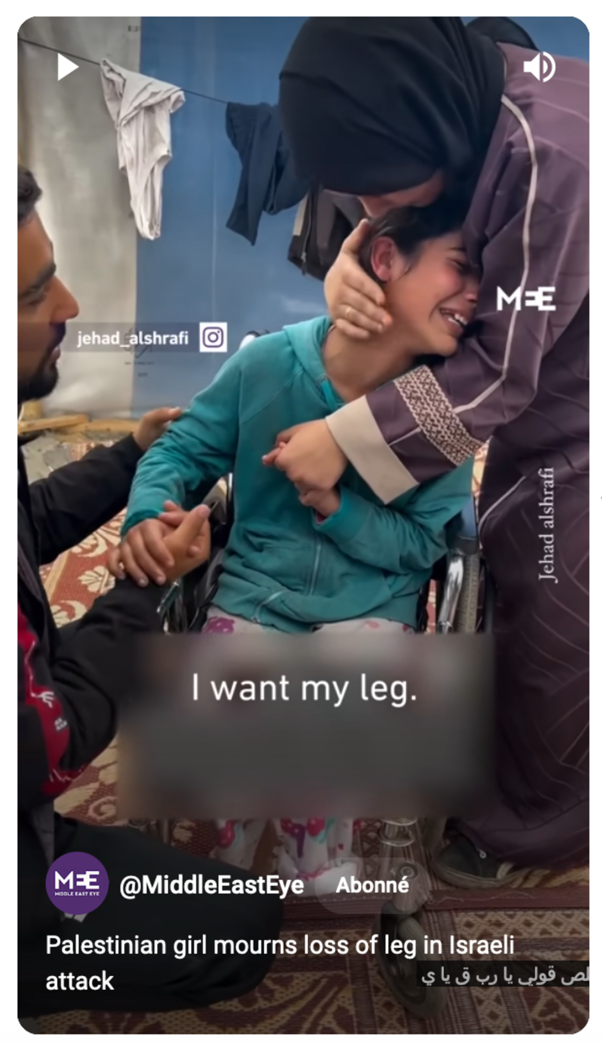 "Je veux ma jambe" | Le Club