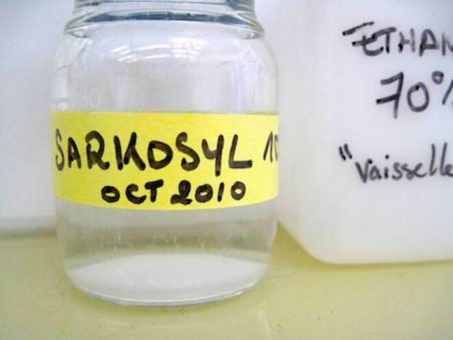 Champion du monde. | Le Club de Mediapart