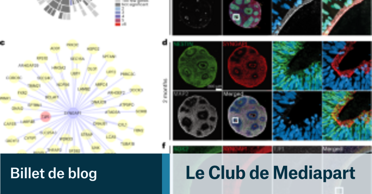 Etude SYNGAP1 et les liens entre les mutations et le handicap ...