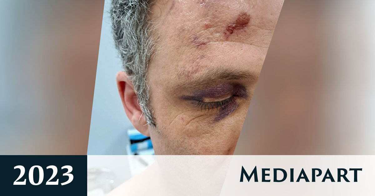 Un adjoint au maire de Montreuil victime d’un guet-apens homophobe | Mediapart